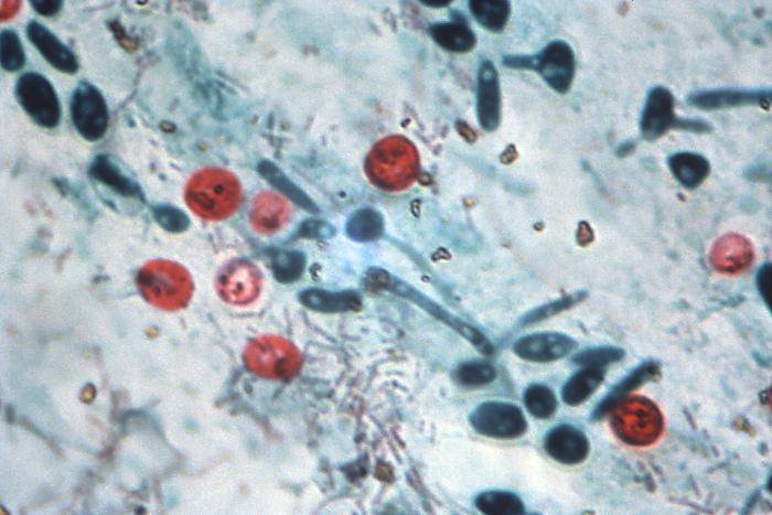 Clase II: Cryptosporidium y Microsporidium | Virtual Lab